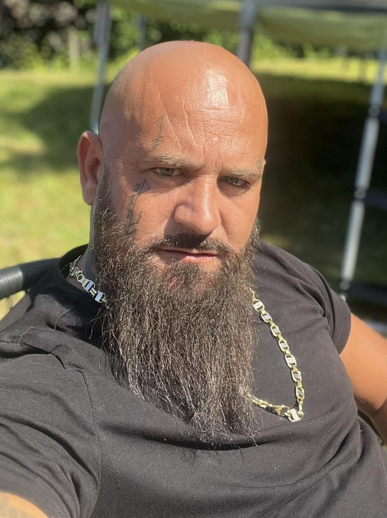 “The Viral Transformation: Catfish Queen Shocks with 20-Year Face ...