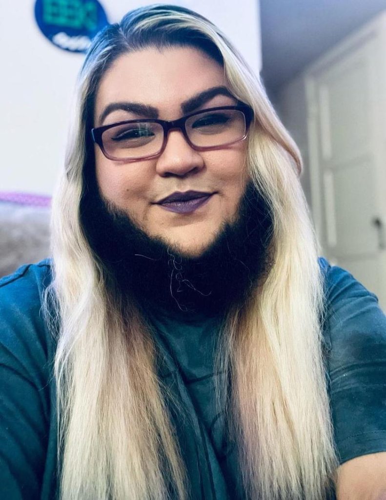 Embracing My Unique Beauty: Woman Proudly Displays Her Beard Despite ...